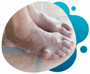 Rheumatoid Arthritis Clinical Trials A Deep Dive | OurWeeks