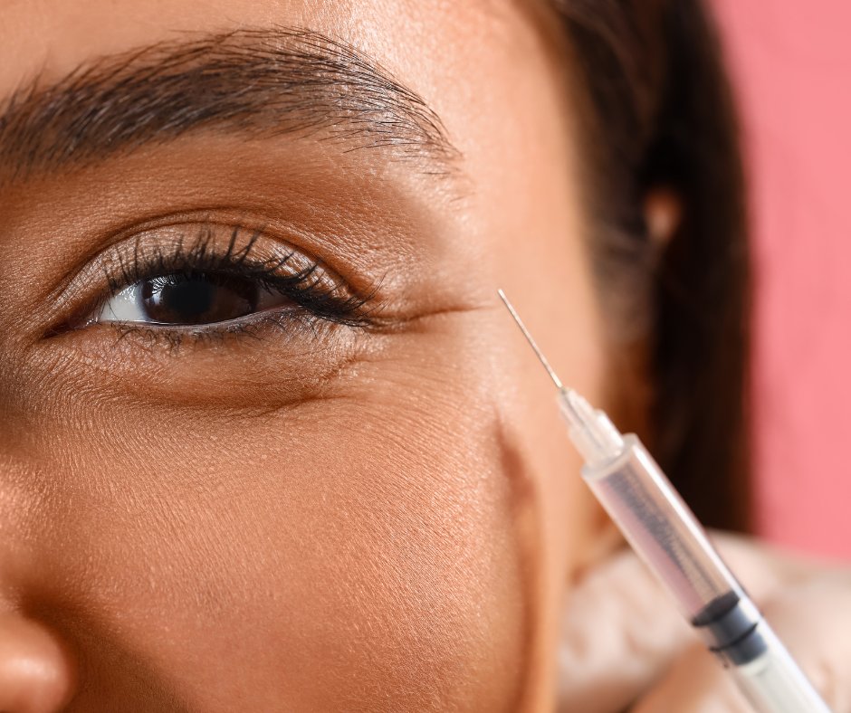 FDA Approves New Under-Eye Filler How It Works | OurWeeks